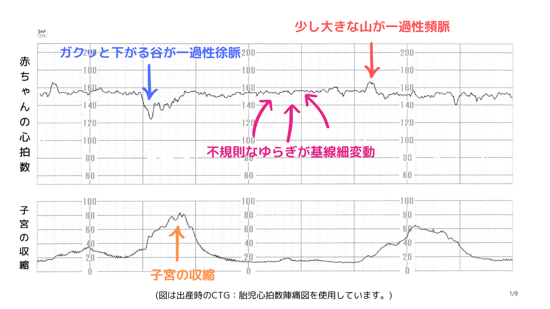 nst 検査: nst つける位置 – DentalCoalition